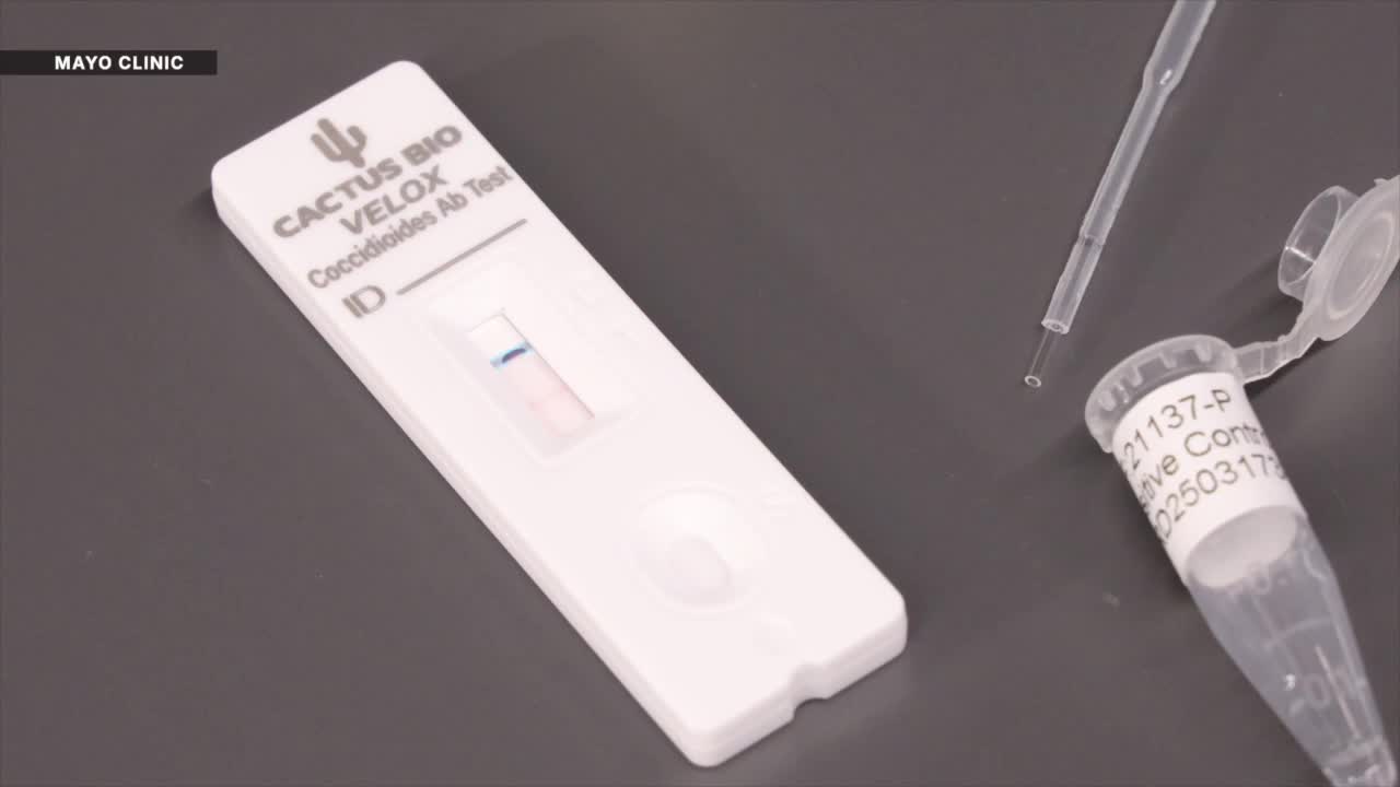 Arizona researchers race to build faster Valley Fever test