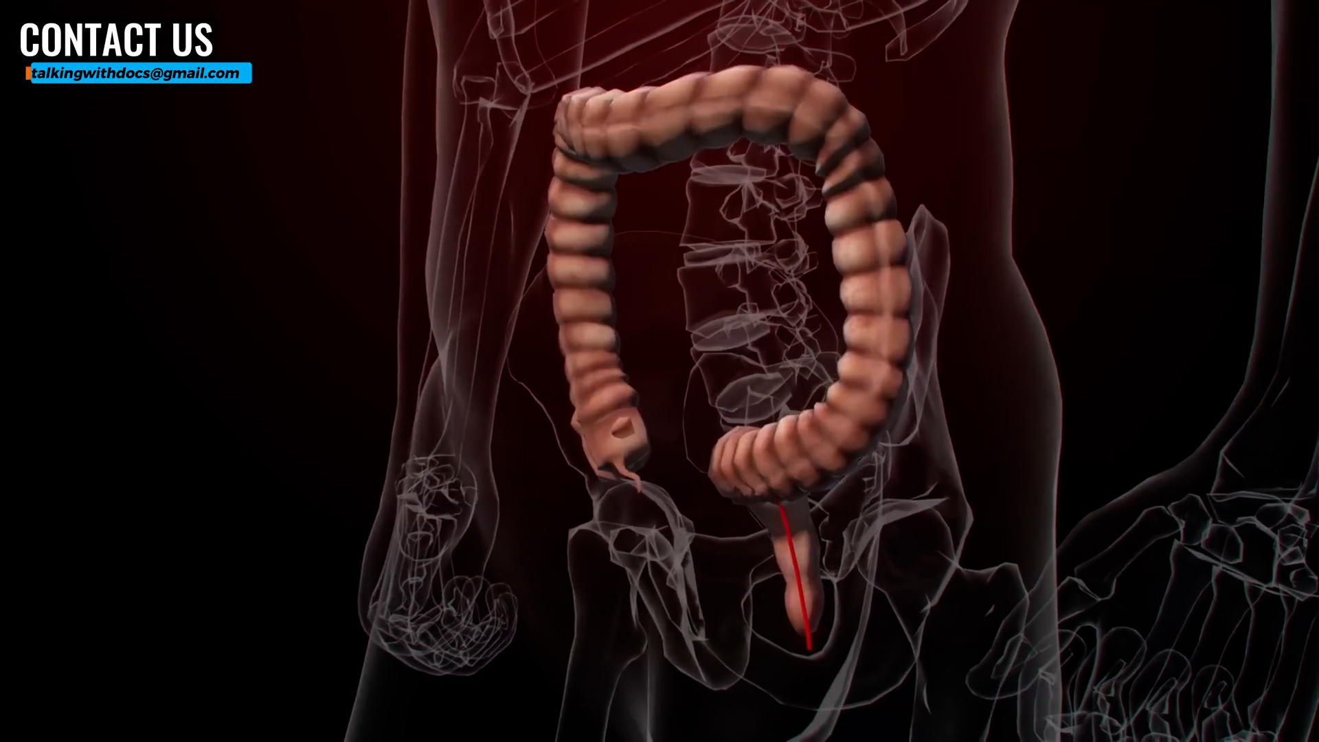 What Dr. Carmen Fong wants you to know about colonoscopy and prevention