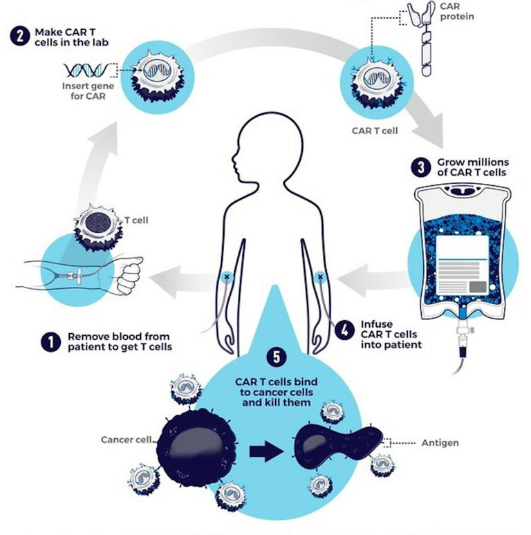 Killing cancer requires immune cells to infiltrate tumors’ hostile ...