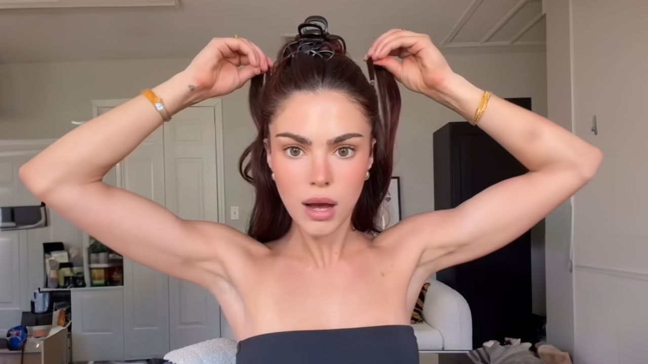 Plastic surgeon explains Anne Hathaway’s facelift illusion