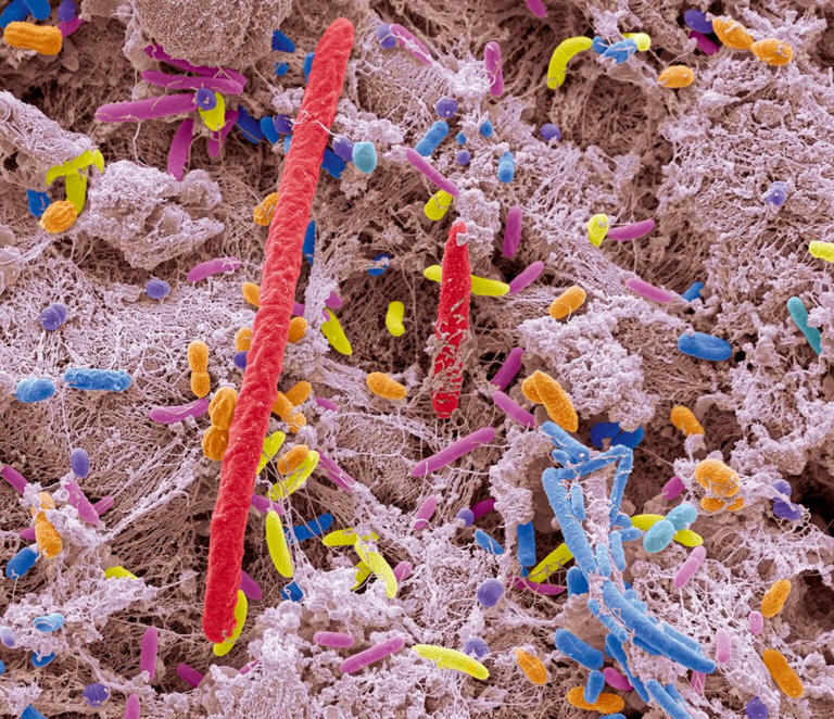 Why bleeding gums are a much bigger problem than most people realise