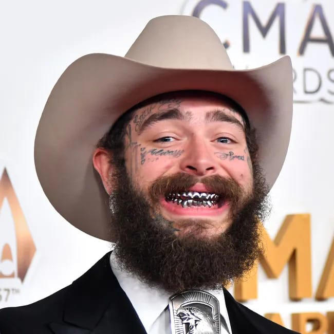 Post Malone flaunts his weight loss in new tour promo clips