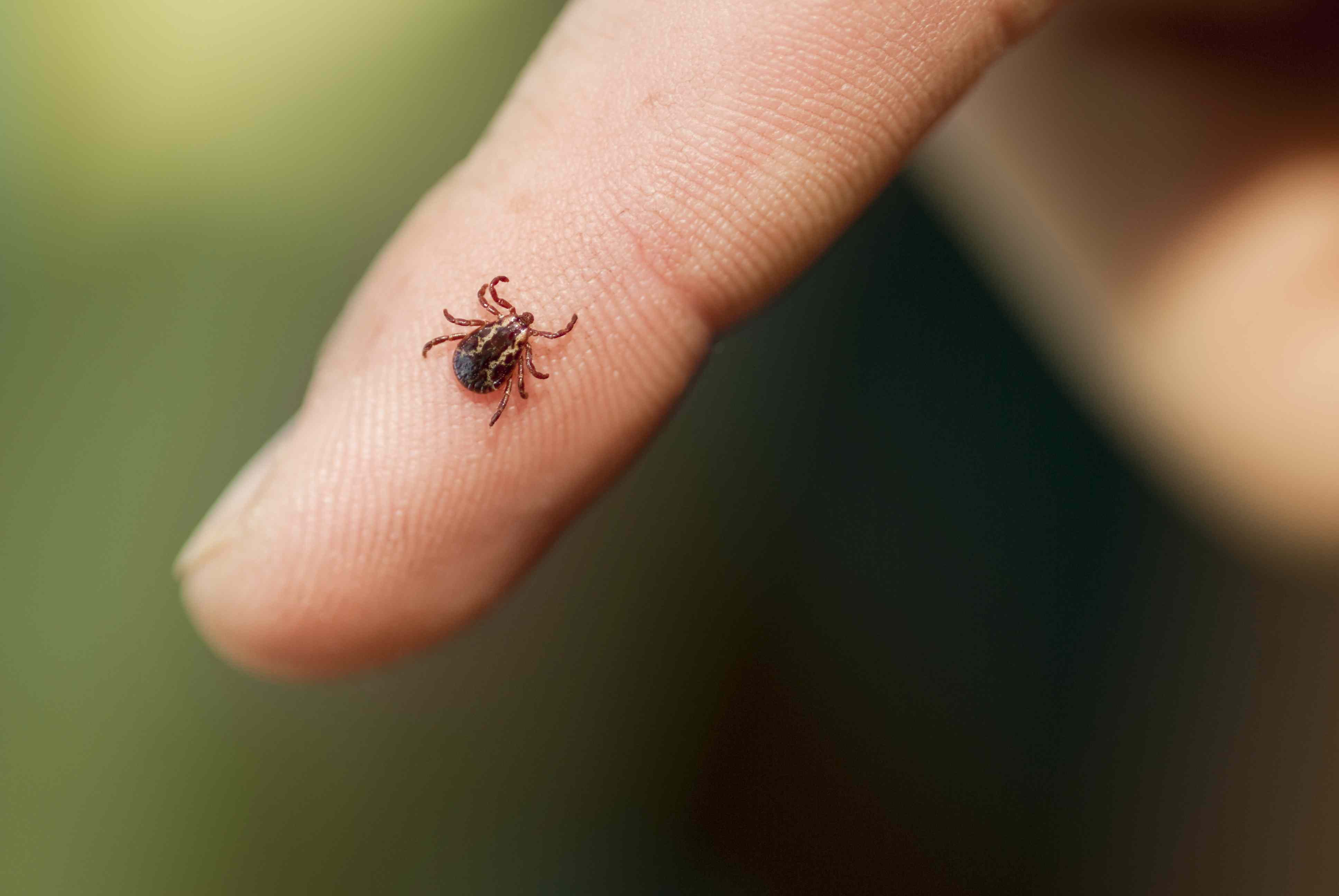 What to do if you find a tick on your body, according to an expert