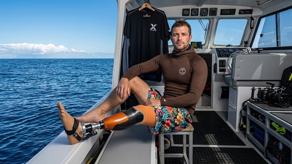 18 years old, one shark attack, and a missing leg