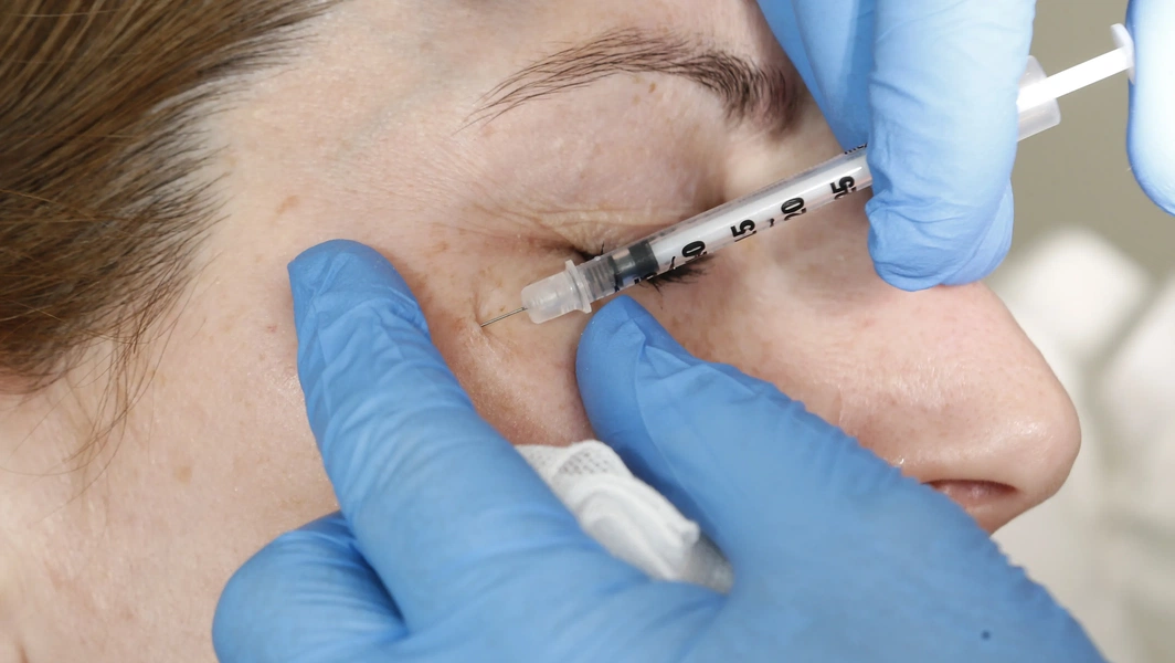 Botox beyond beauty for real relief