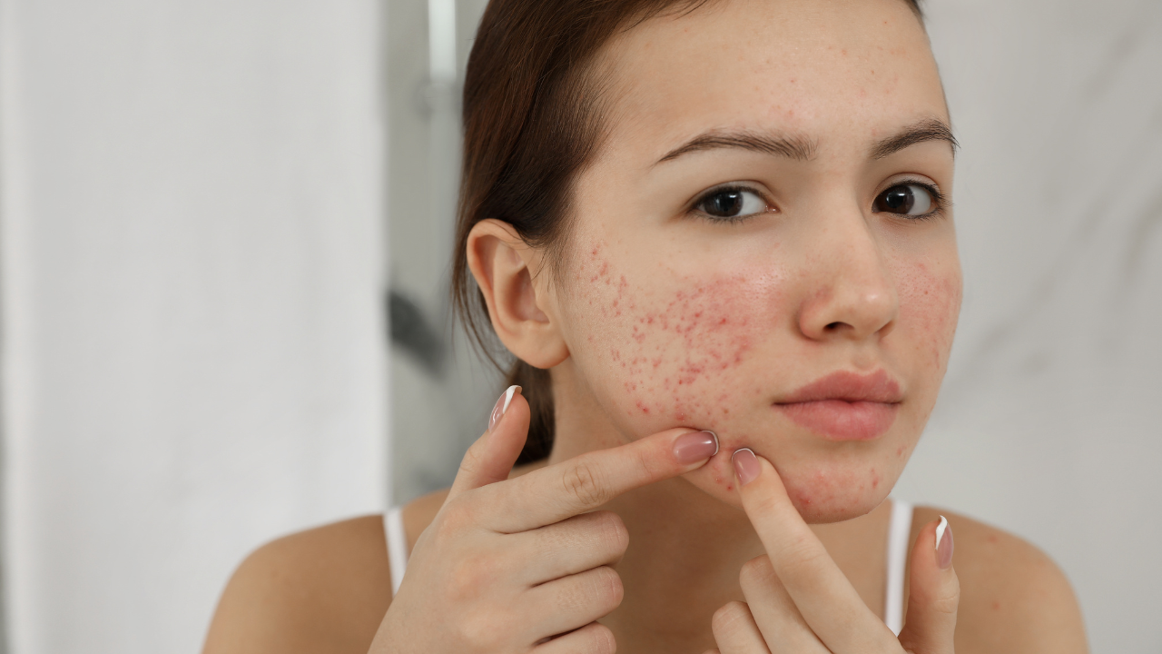 Your skin may be revealing what’s happening inside your gut: Doctors ...