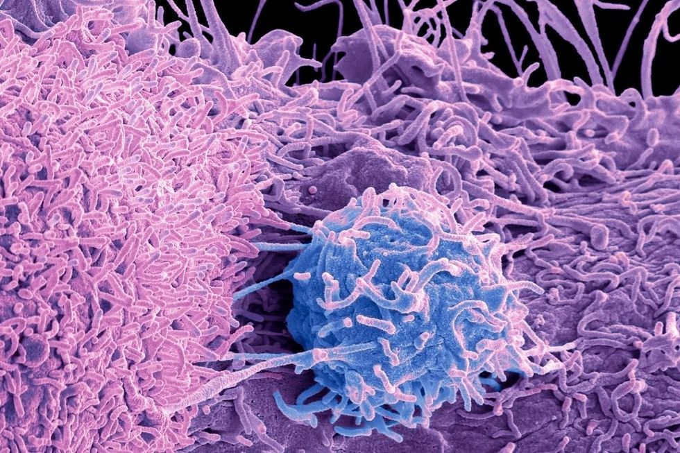 The prostate cancer warning sign men are missing in the night ...