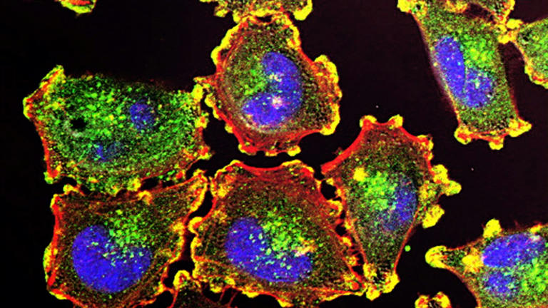 Your body builds roughly 330 billion new cells every single day