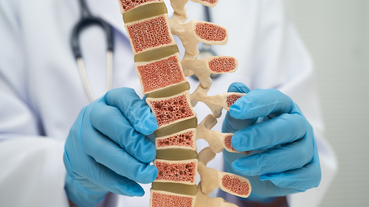 Think osteoporosis is a women's disease? Here's why men should be ...