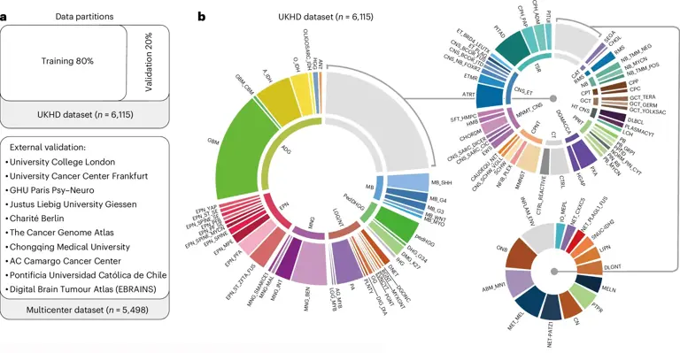 New AI system identifies 102 brain tumor types in minutes instead of weeks