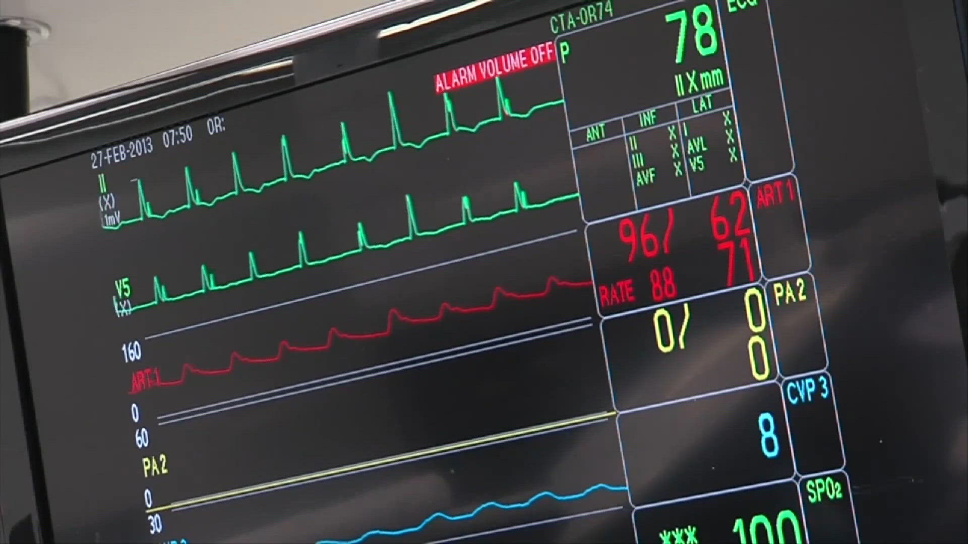 Letter to Tennessee families with critically ill children sparks debate ...