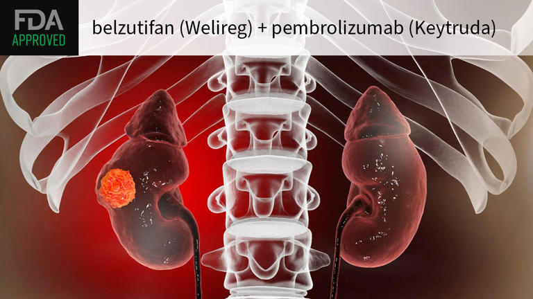 Adjuvant combination for kidney cancer gets FDA's blessing