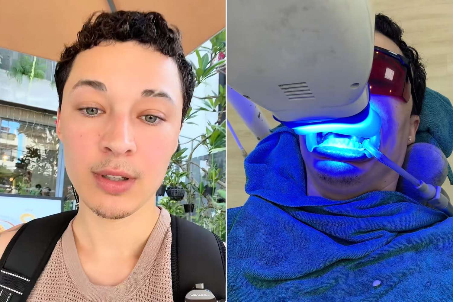 Man’s dental filling cracked on vacation. What he paid to fix it in ...