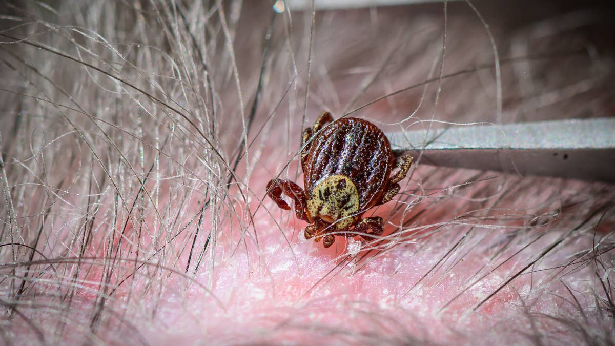 California reports fourth case of new tick-borne disease linked to ...