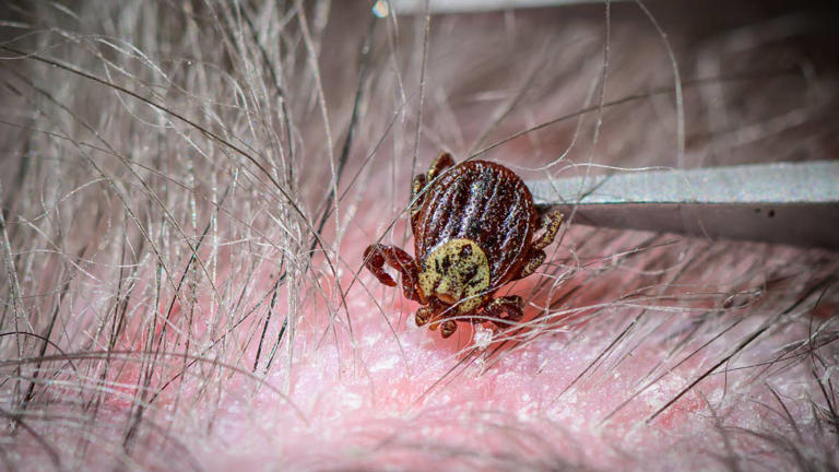 California reports fourth case of new tick-borne disease linked to ...