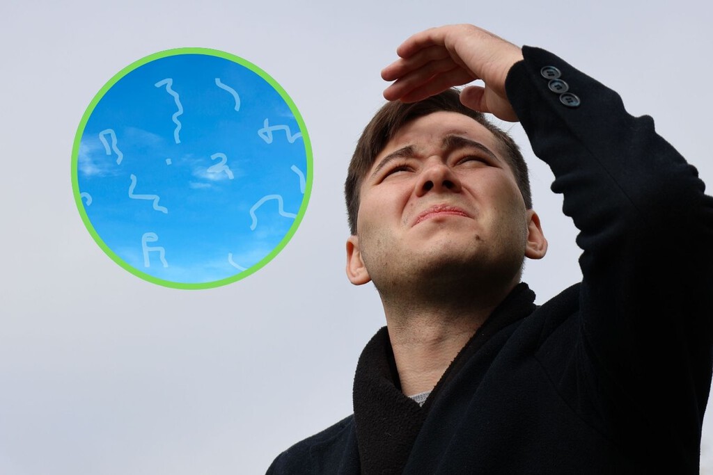 Si ves puntos o hilos flotando frente a tus ojos cuando miras al cielo ...
