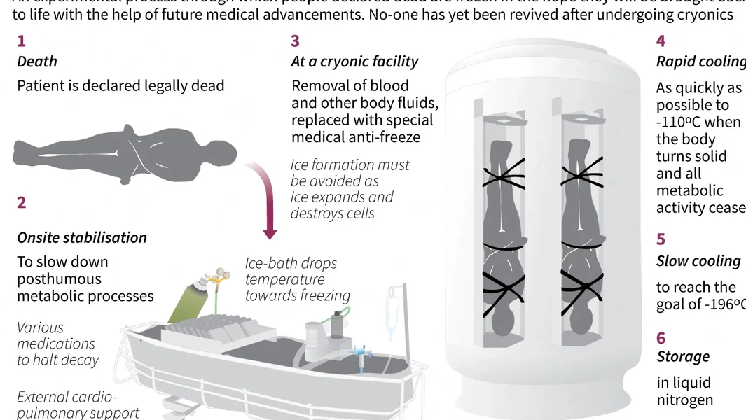 James Bedford’s fortune and cryonic preservation