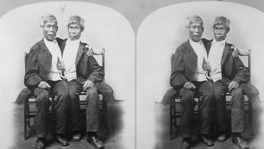 Life and legacy of Chang and Eng Bunker