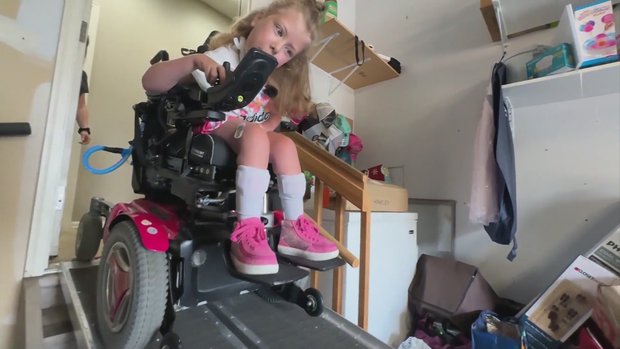 Northern Colorado girl becomes first-known childhood brain stem cancer ...