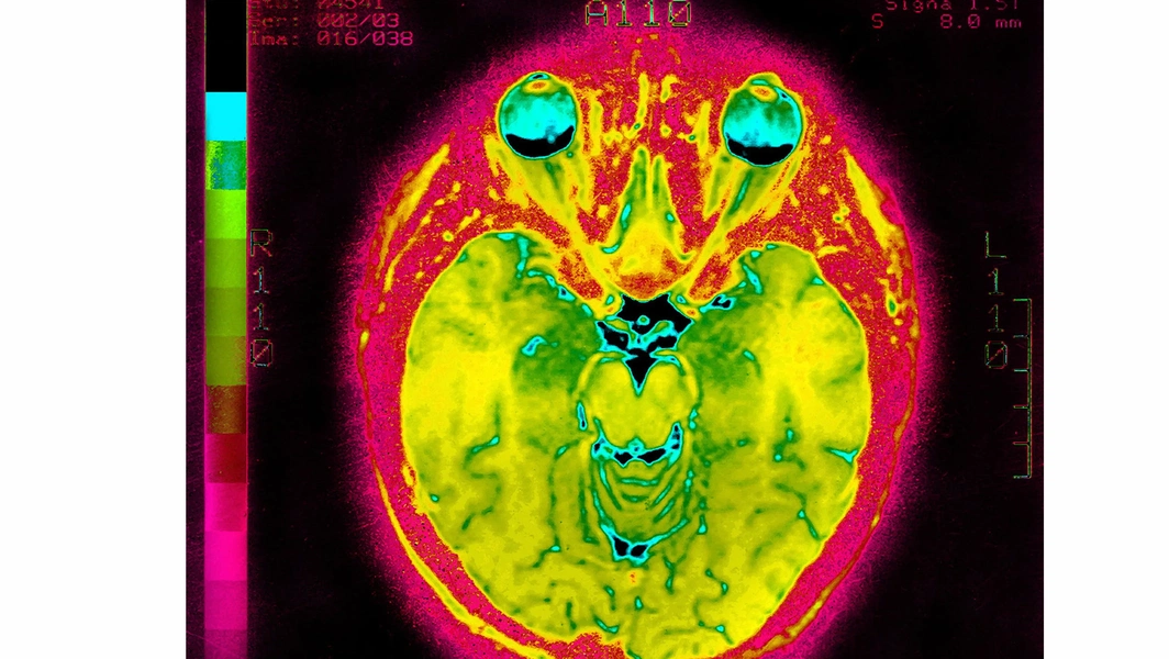 Brain structure and function in psychopathy