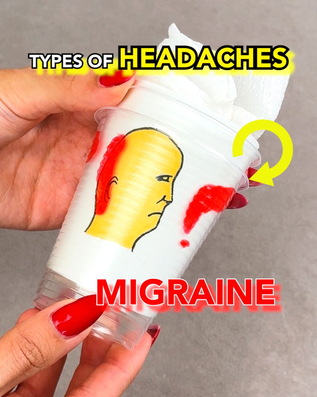 Understanding different types of headaches