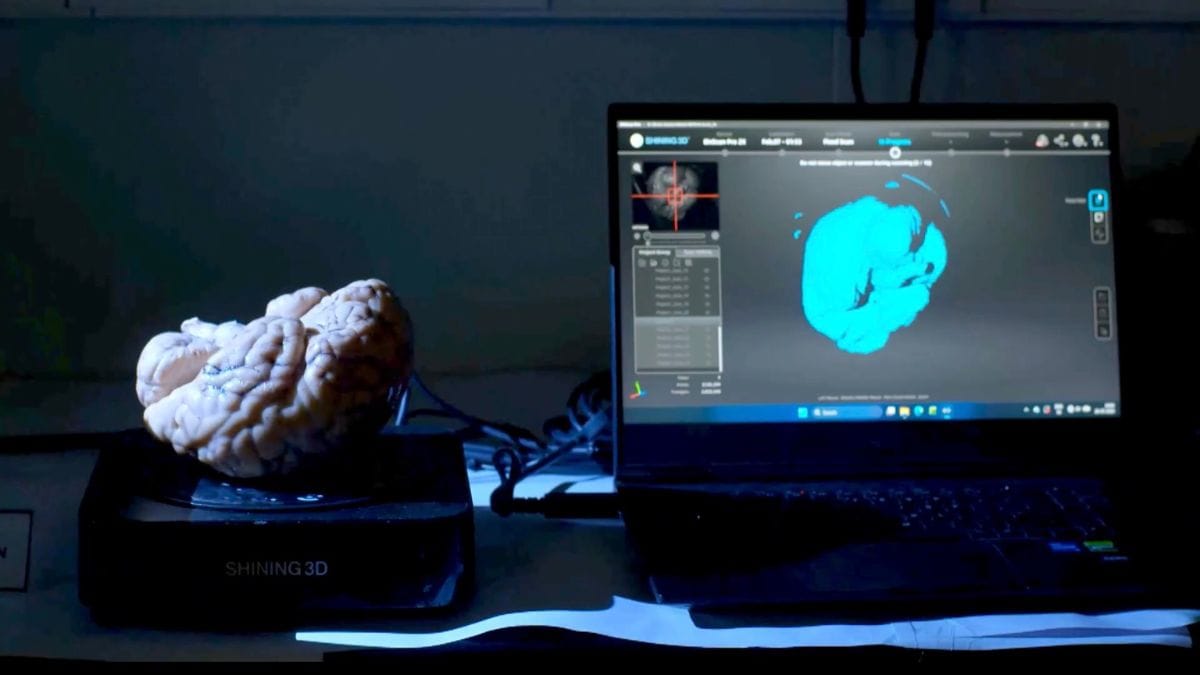 A Google Maps for the brain? IIT Madras releases detailed 3D atlas of ...