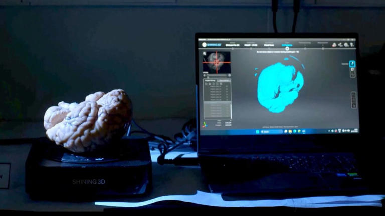A Google Maps for the brain? IIT Madras releases detailed 3D atlas of ...