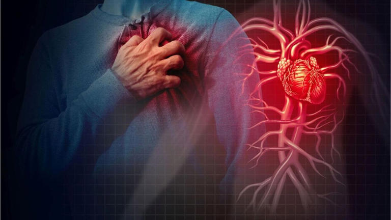 Cholesterol report alone cannot predict heart attack risk, says ...