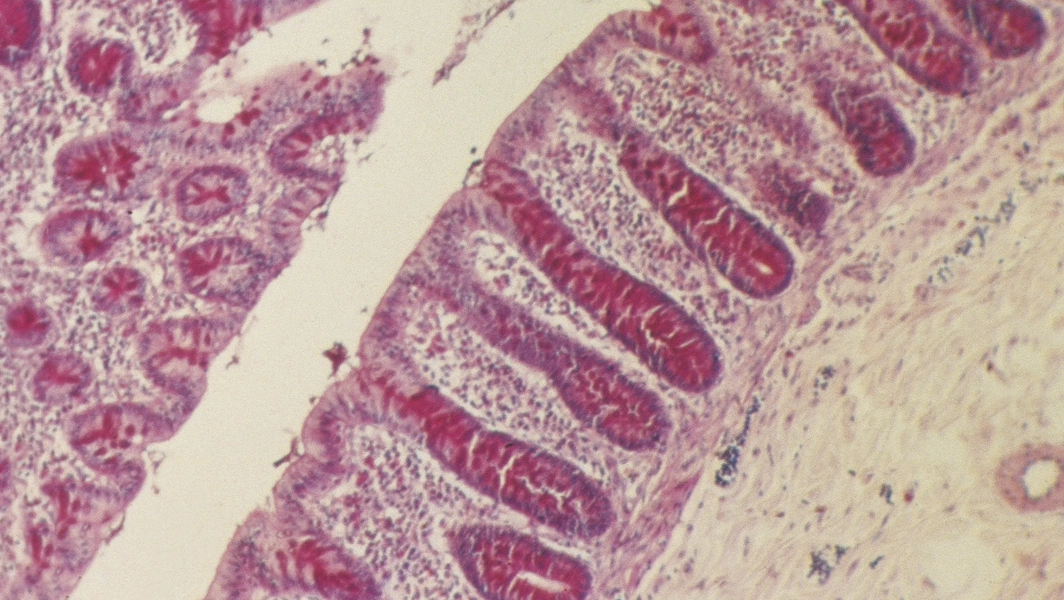 Revised count shows bacteria barely outnumber human cells