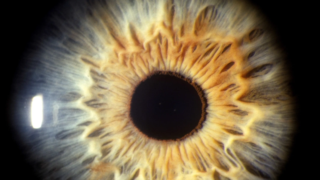 Genetics and global rarity of eye colors