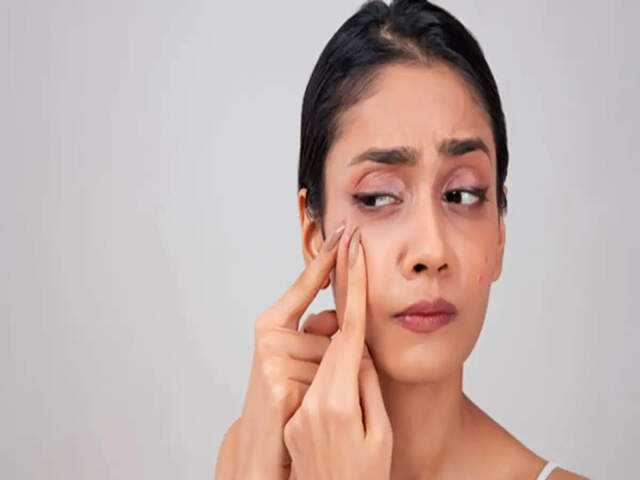 Essential monsoon beauty tips for healthy skin and hair