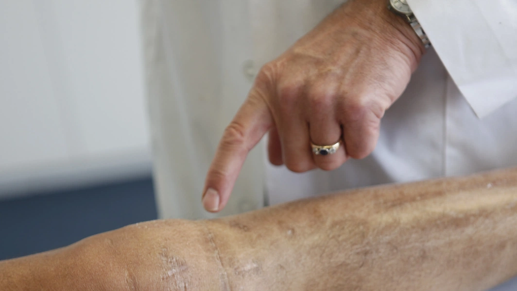 8 causes of pain behind the knee