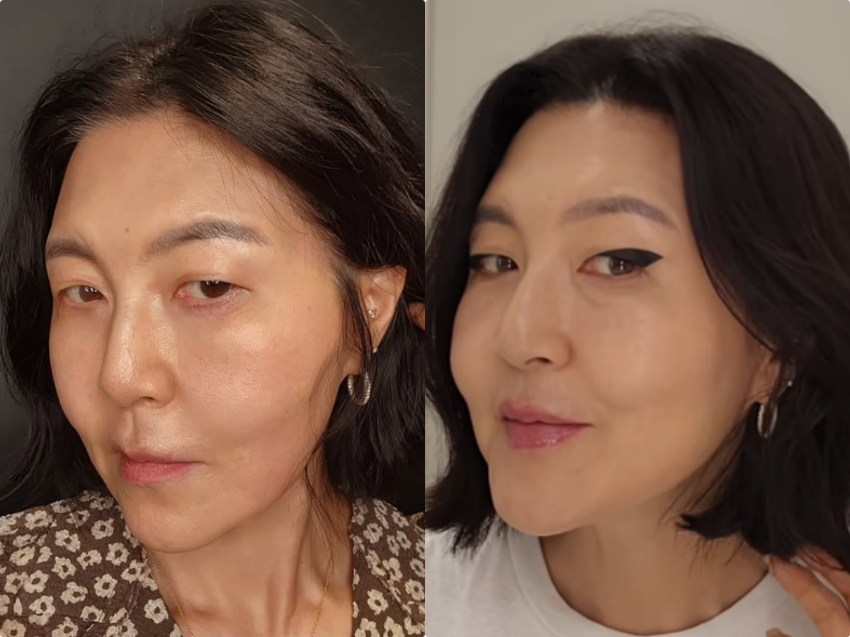 ‘44kg’ 한혜연, 16kg 감량 후 턱선 무너졌다…결국 시술 [SD셀픽]