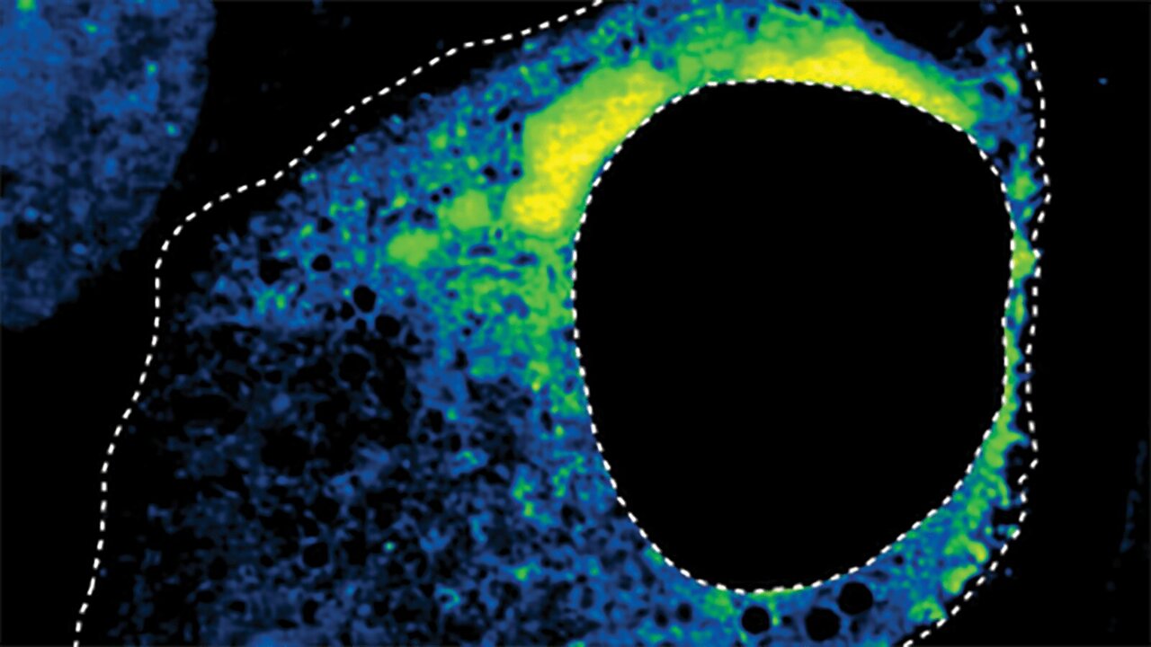 AI sorts cell droplets into four shapes, uncovering drug effects in ...