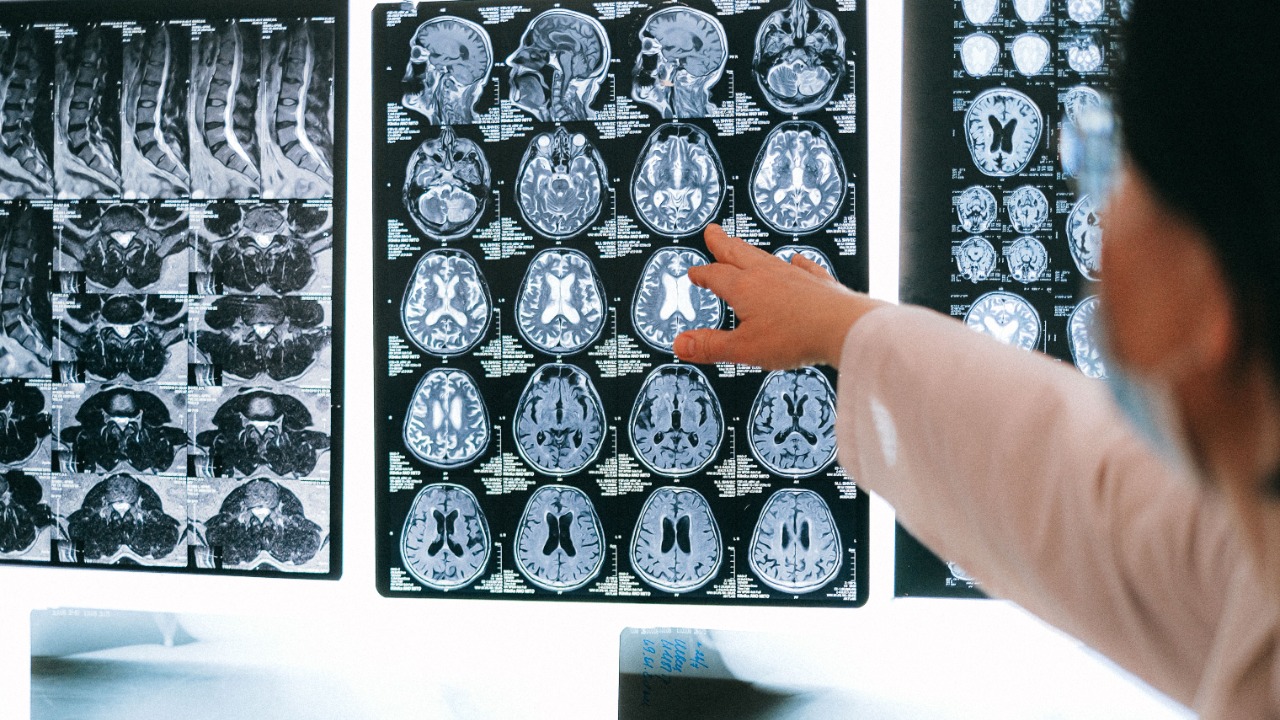 A 343-patient trial found a new drug combo extended survival in an ...