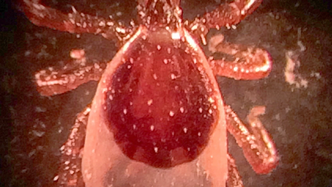 Rare Lyme disease bacterium detected in New York ticks