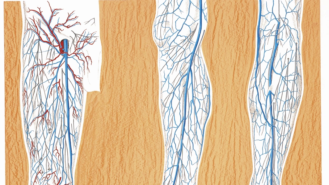 Health risks and solutions for prolonged sitting