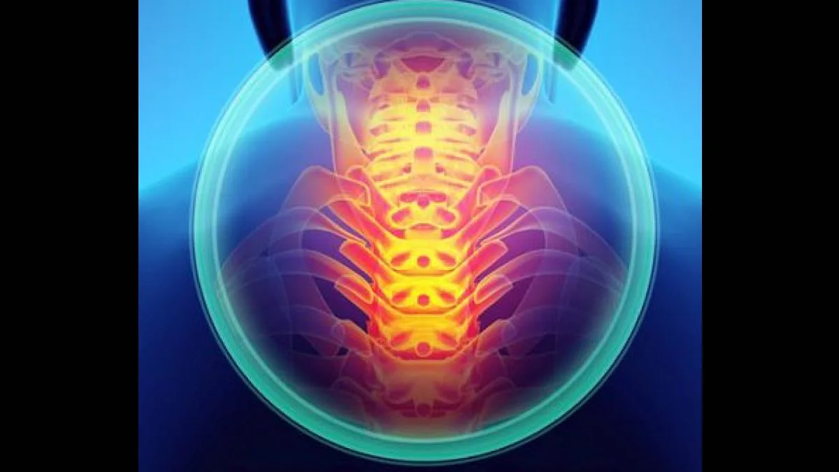 Motion-preserving spine surgery offers new hope for young patients with ...