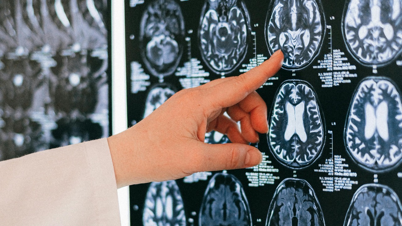 An experimental therapy wiped out brain tumors in 83% of treated lab ...