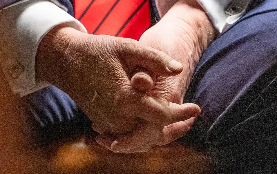 Trump's public naps and hand injury fuel health debate