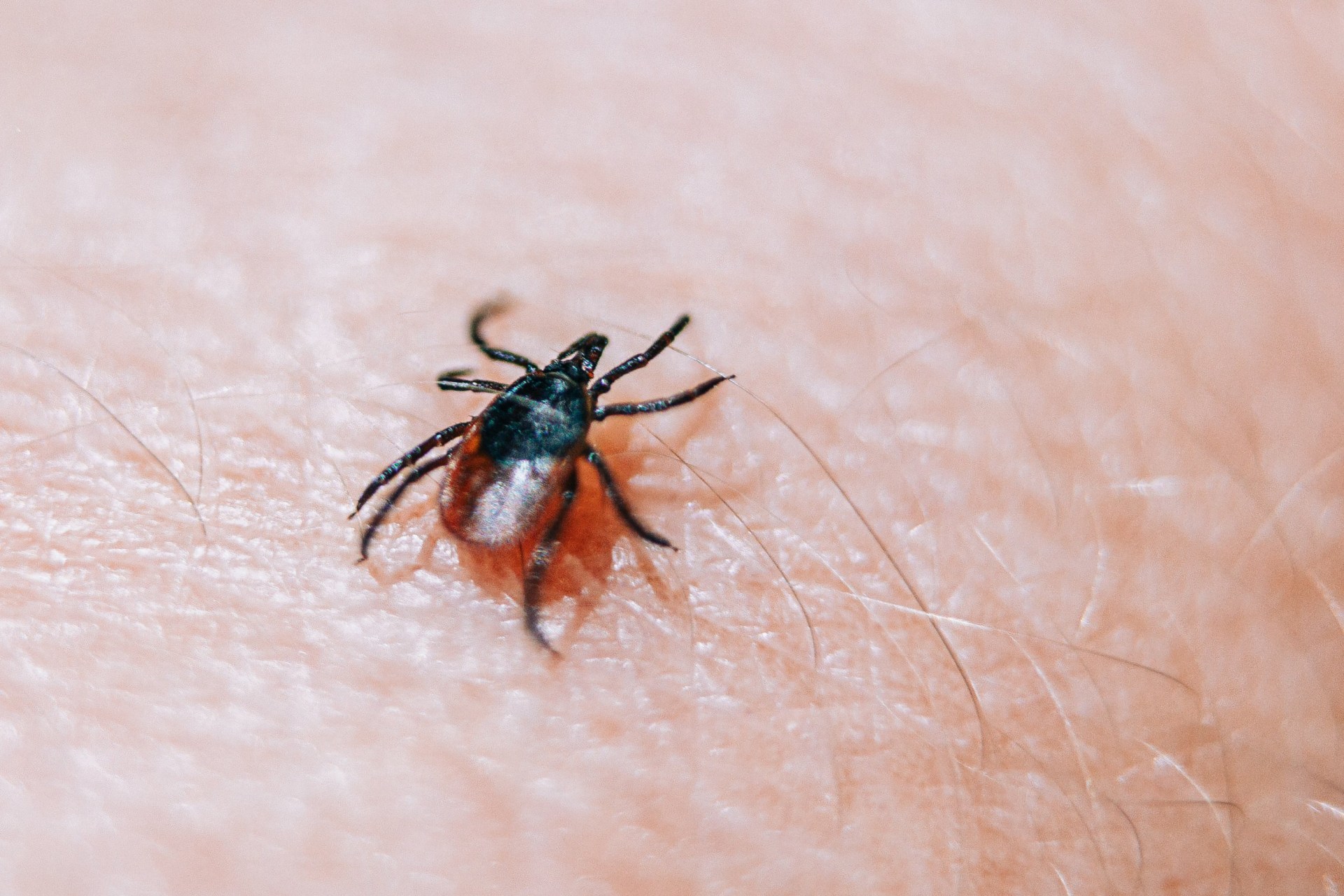 This tick bite could suddenly give you a life-threatening allergy to meat