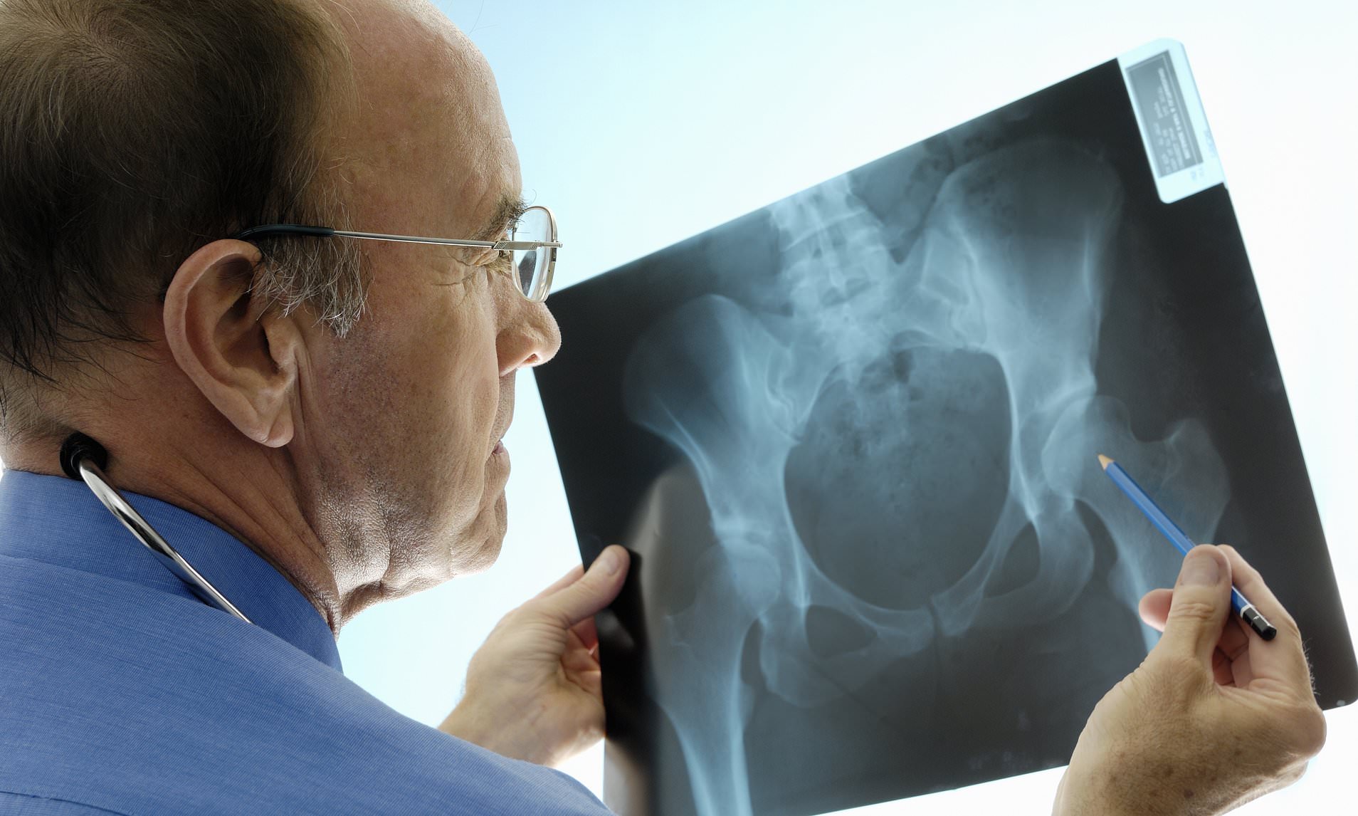 Promise on bone clinics set to be broken as government admits it does ...