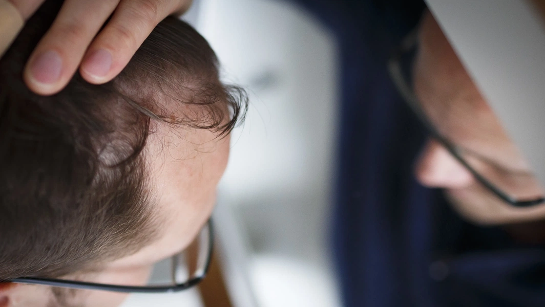 11 proven treatments and styling tips for thinning hair