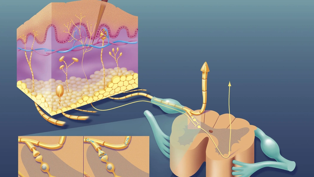 Understanding nerve damage and its causes