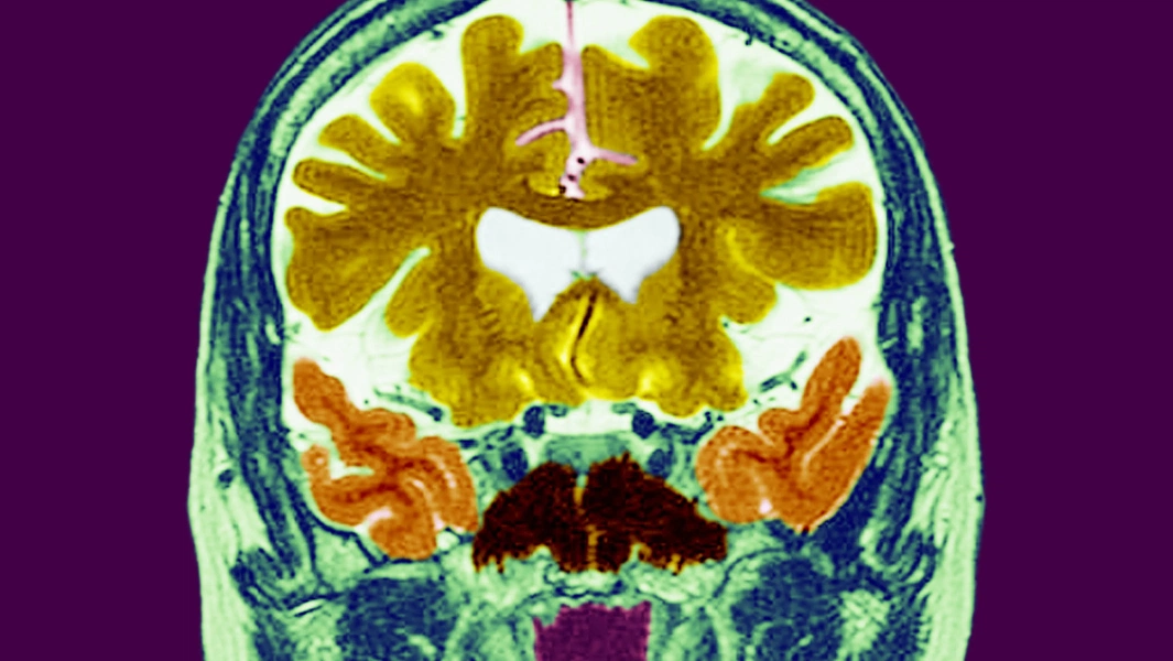 How prayer influences the brain and emotions