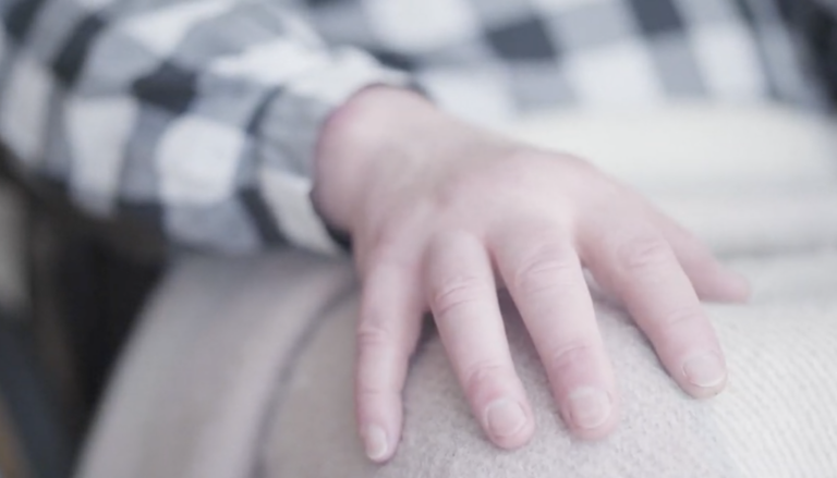 What happens to your body when you get rabies day by day