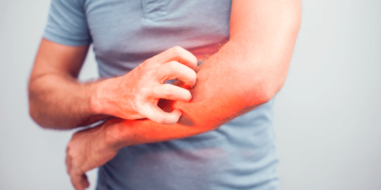 How to get rid of no see ums: Effective strategies and tips