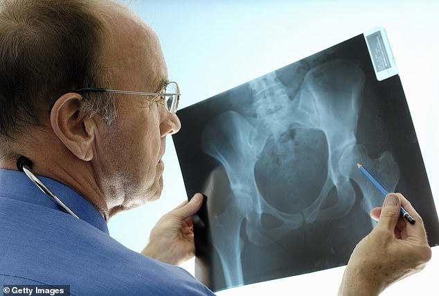 Promise on bone clinics set to be broken as government admits it does ...