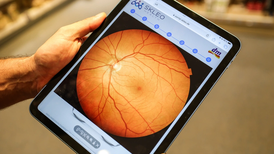 Serious eye symptoms and their potential causes