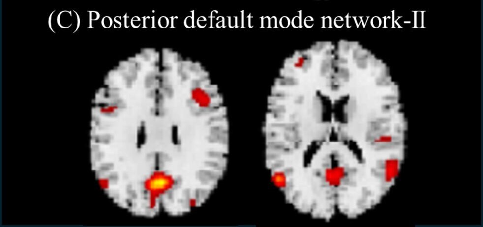 Vitamin C levels in blood plasma linked with brain connectivity and ...